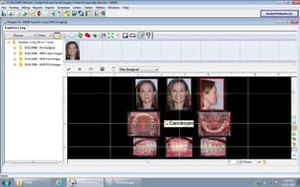 Carestream Dental Imaging Reviews 2025: Details, Pricing, & Features | G2