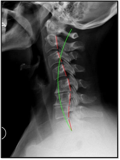 PostureRay Reviews 2025: Details, Pricing, & Features | G2