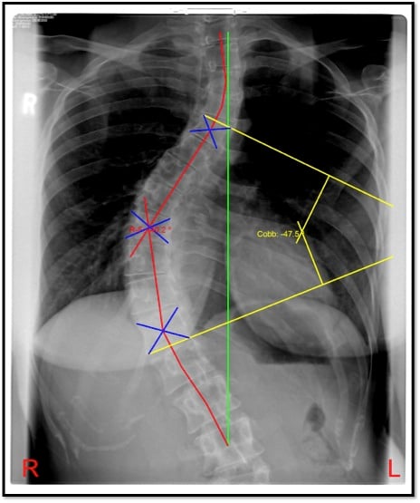 PostureRay Reviews 2025: Details, Pricing, & Features | G2