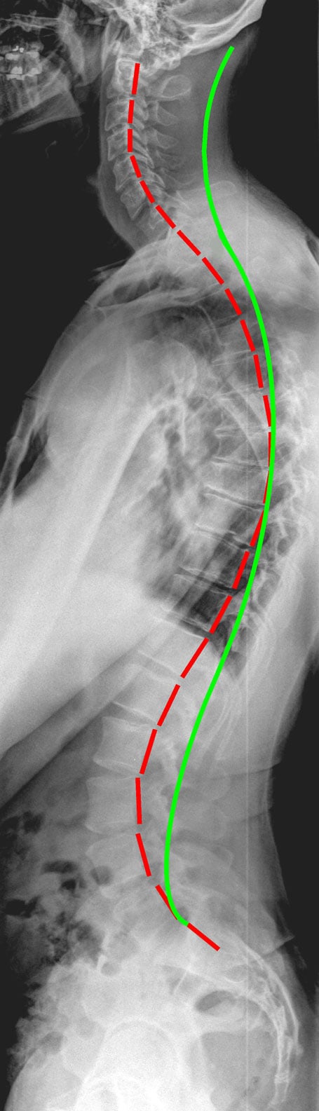 PostureRay Reviews 2025: Details, Pricing, & Features | G2